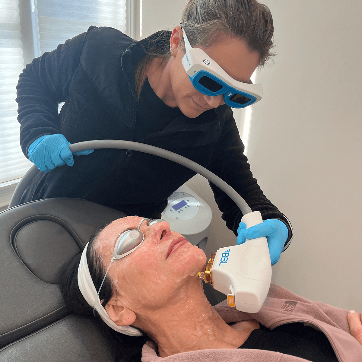 BroadBand Light Therapy Clarity Medical Aesthetics