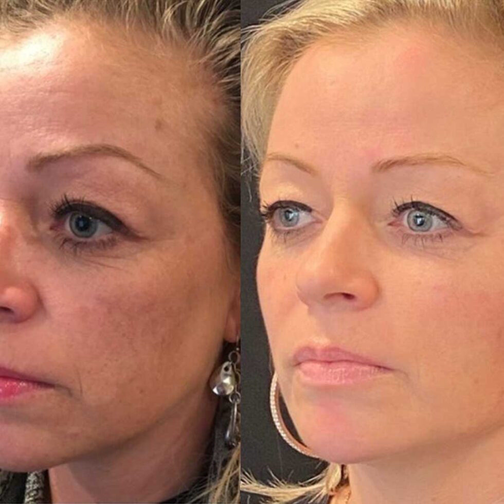 Anti-Aging Treatment - Clarity Medical Aesthetics